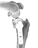 TPLO vs TTA vs ECR: a review of scientific studies - BoneVet Orthopaedics